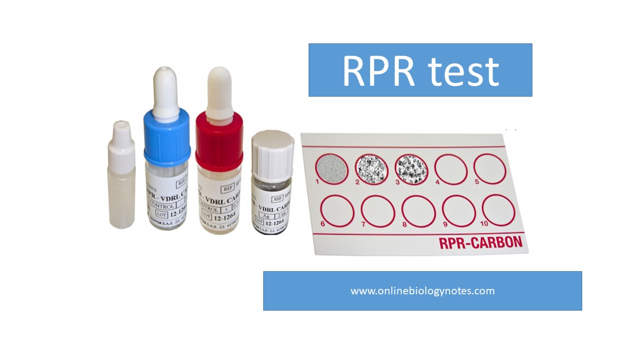 RPR Test Principle Procedure Result Interpretation And Application RPR Test Principle Procedure Result Interpretation And Application