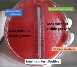 Satellitism test for identification of Haemophilus influenzae - Online ...